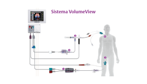 VolumeView en críticos. Manejo de enfermería. ( por Alba Outeda ...