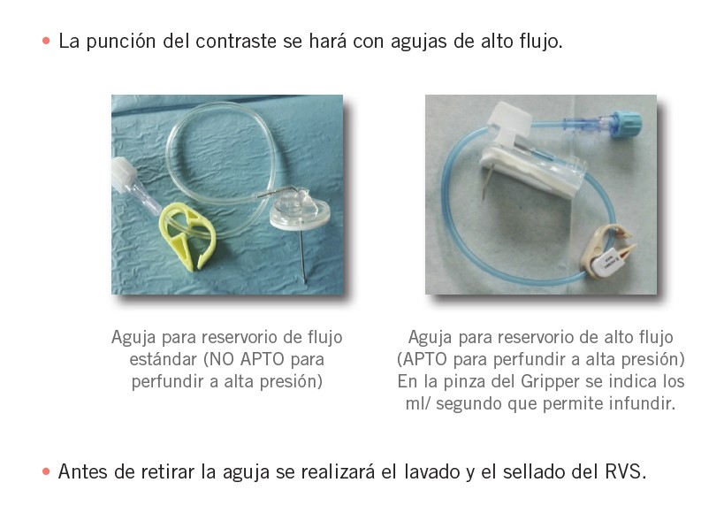 PORT A CATH y PICC Port: Punción y manejo de enfermería ...